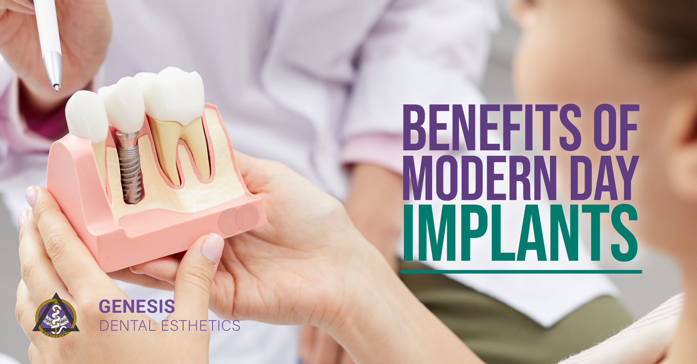 History Of Dental Implants And Today’s Technology in Pasadena